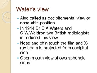 Radiology of nose and paranasal sinuses | PPTX