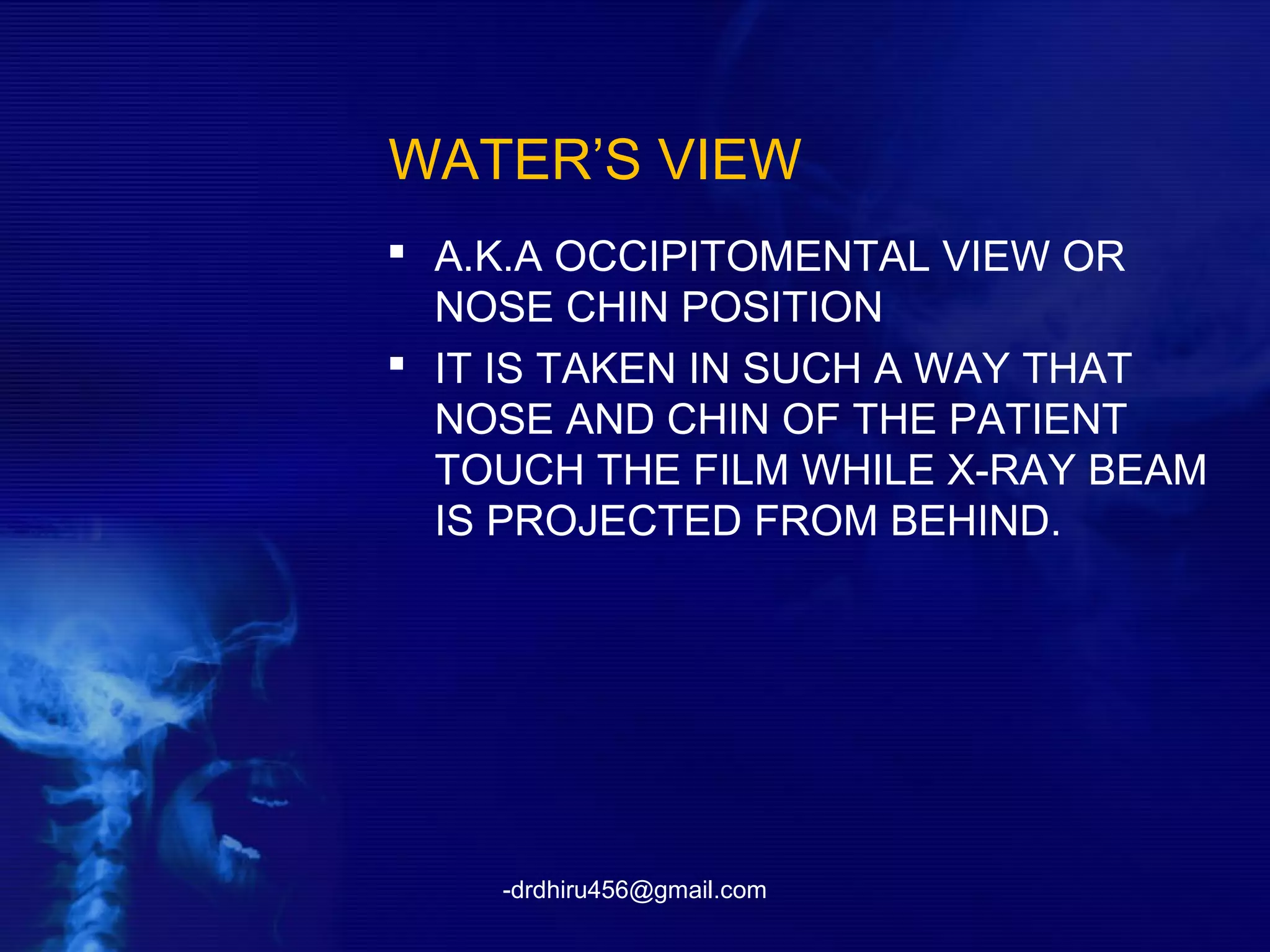 Radiology of nose and pns (by drdhiru456) | PPT