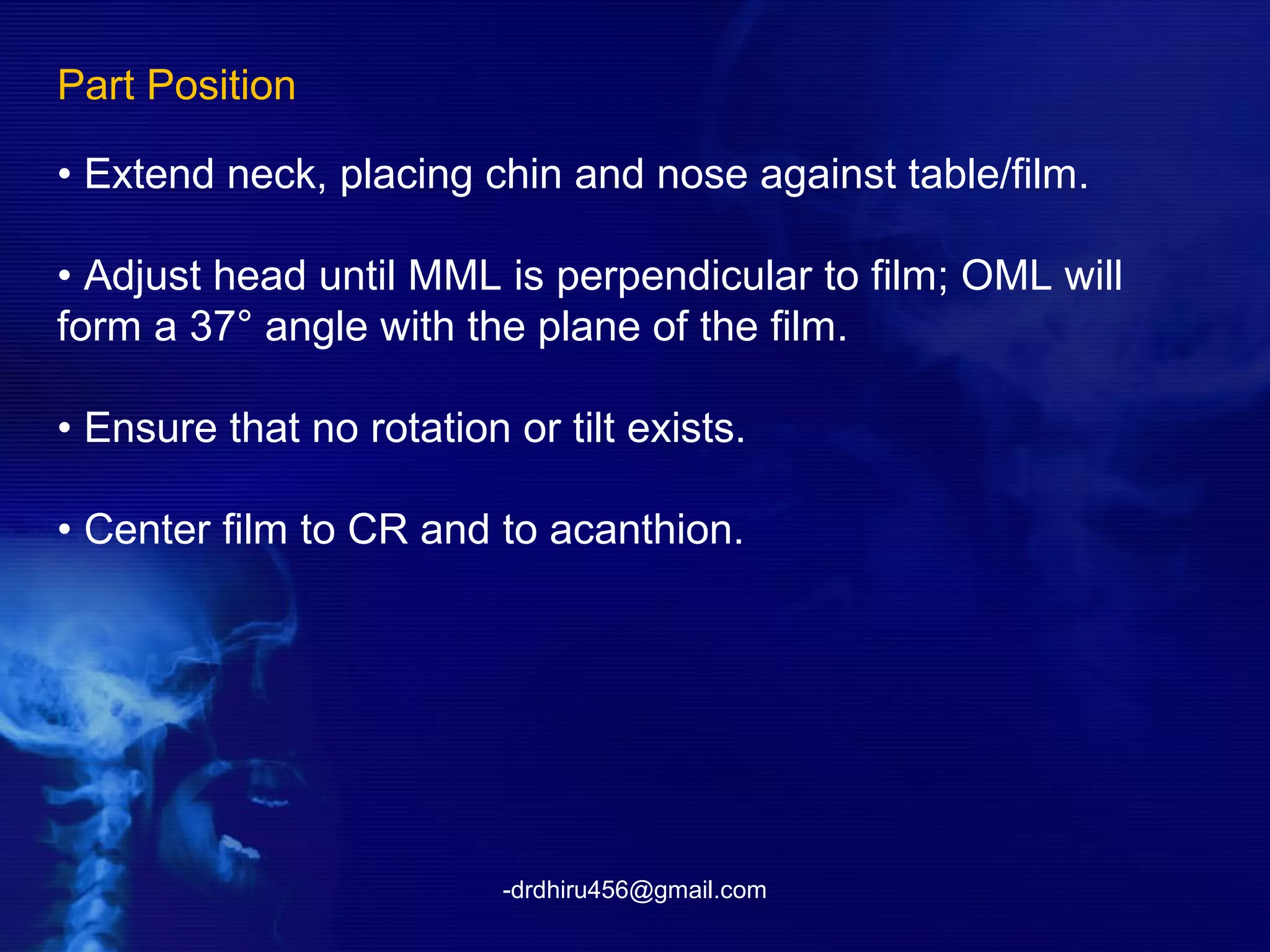 Radiology of nose and pns (by drdhiru456) | PPT