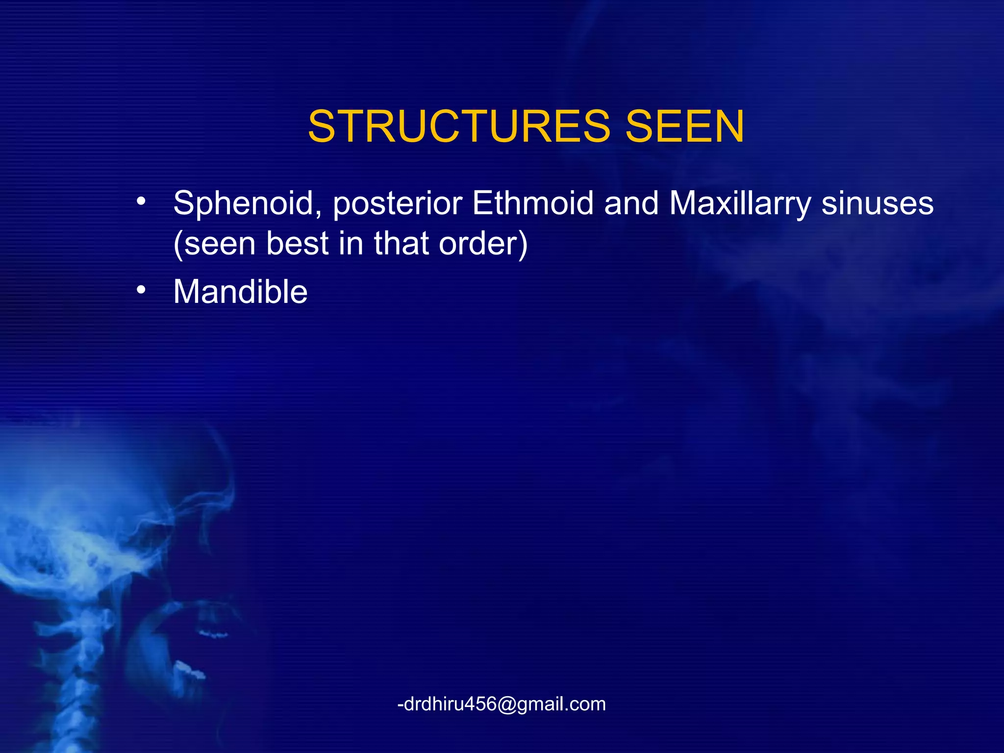 Radiology of nose and pns (by drdhiru456) | PPT