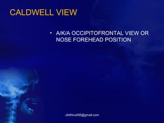 Radiology of nose and pns (by drdhiru456) | PPT
