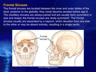 Radiology of nose and pns (by drdhiru456) | PPT