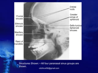 Sphenoid Sinus X Ray