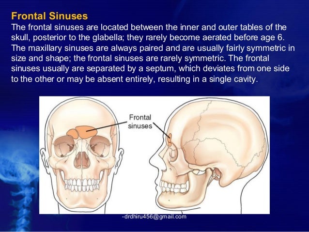 Radiology of nose and pns (by drdhiru456)