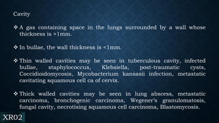 Radiology of Tuberculosis | PDF