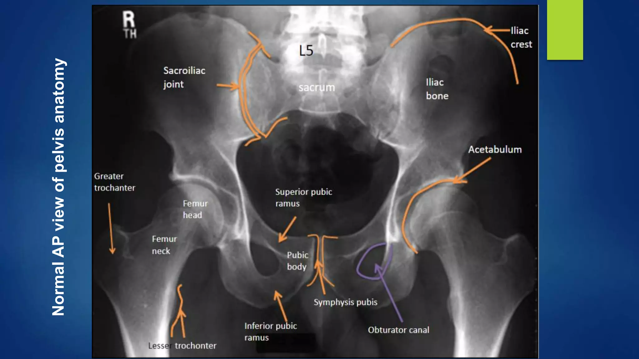 Radiology of the lower extremity dr asif ali khan | PPTX