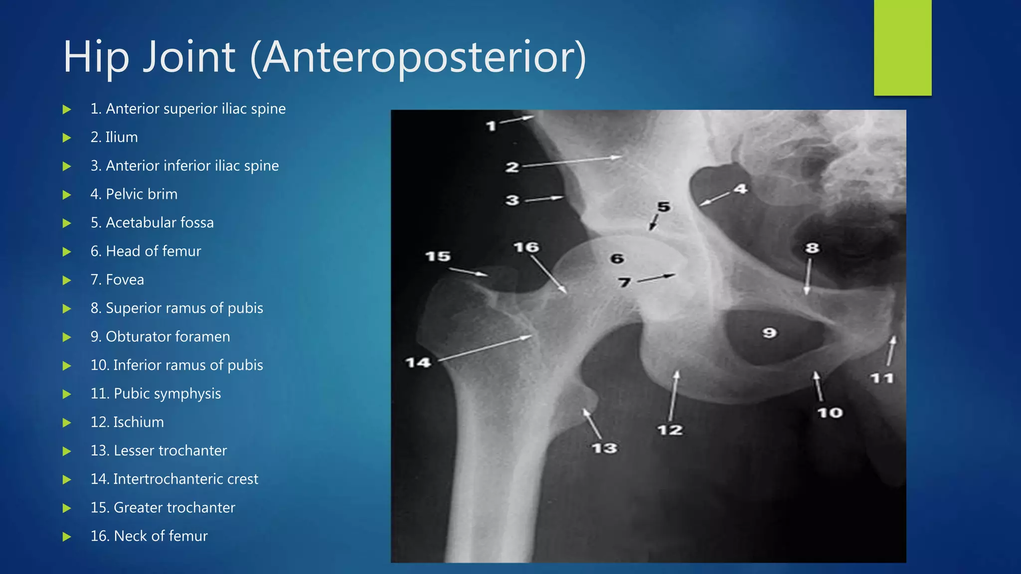 Radiology of the lower extremity dr asif ali khan | PPTX