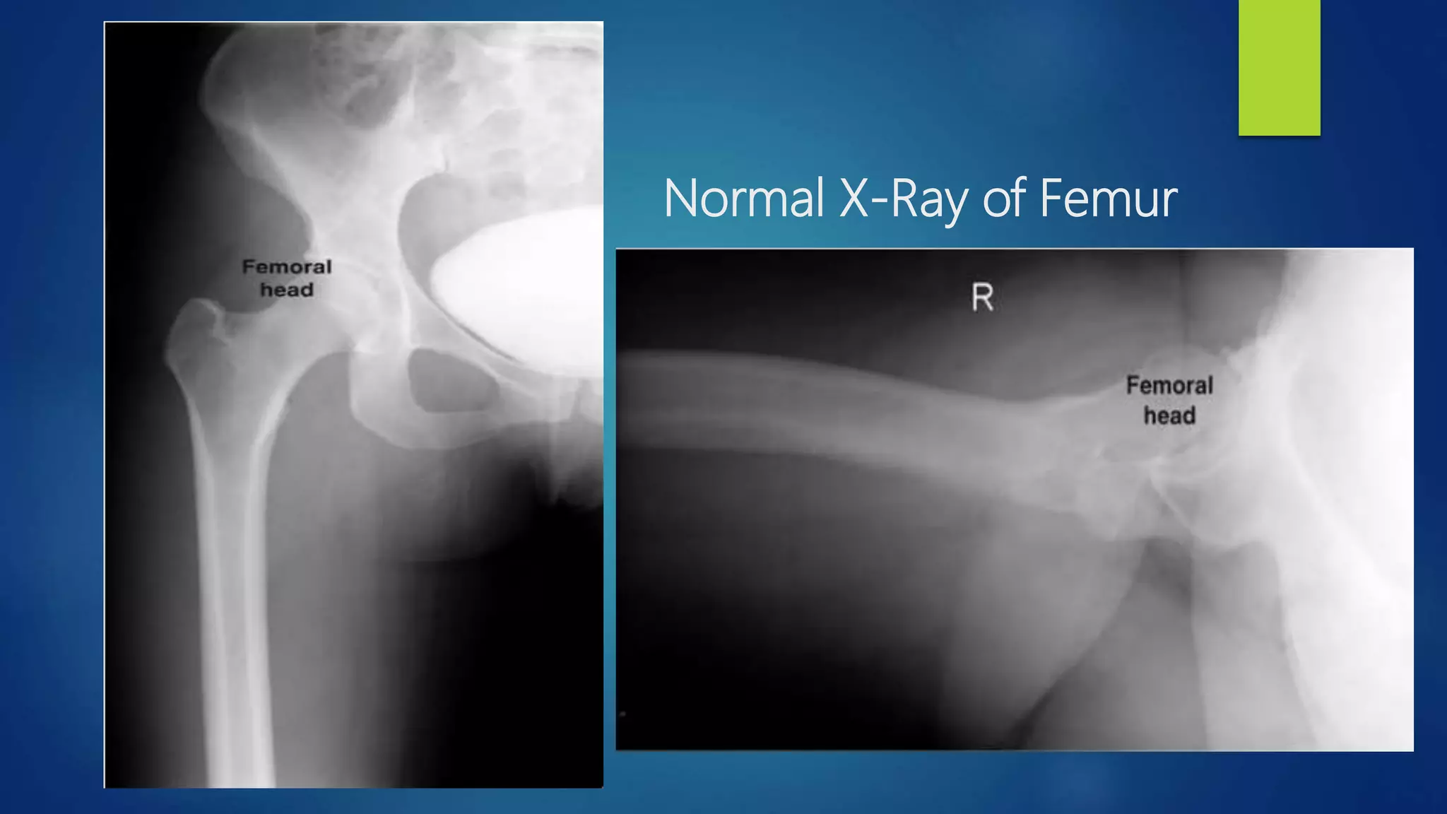 Radiology of the lower extremity dr asif ali khan | PPTX