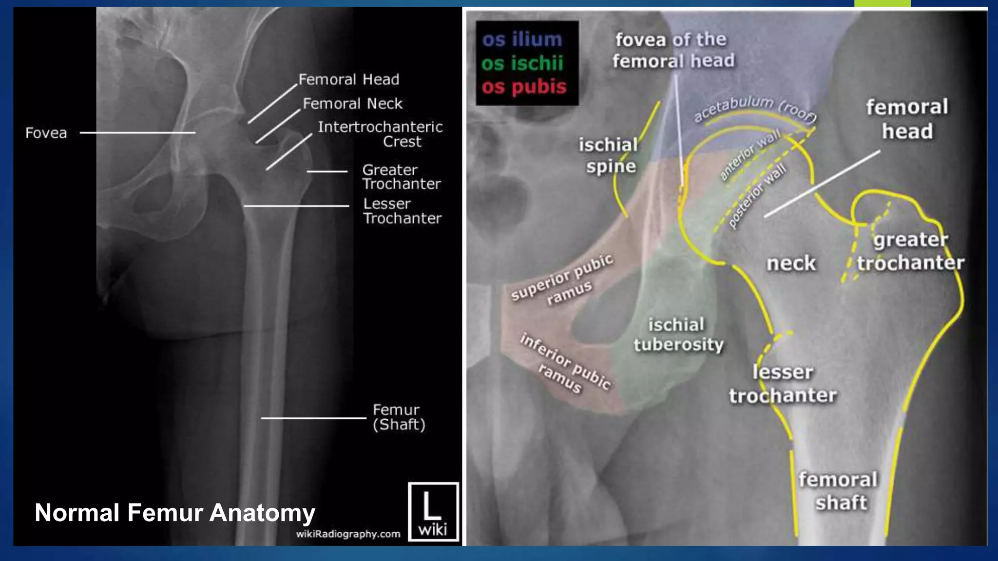 Radiology of the lower extremity dr asif ali khan | PPTX