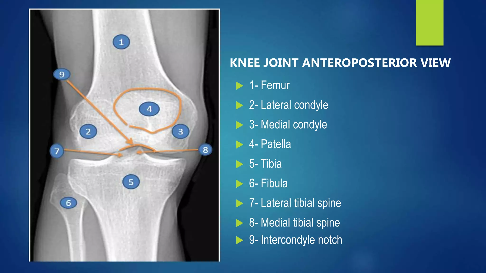 Radiology of the lower extremity dr asif ali khan | PPTX