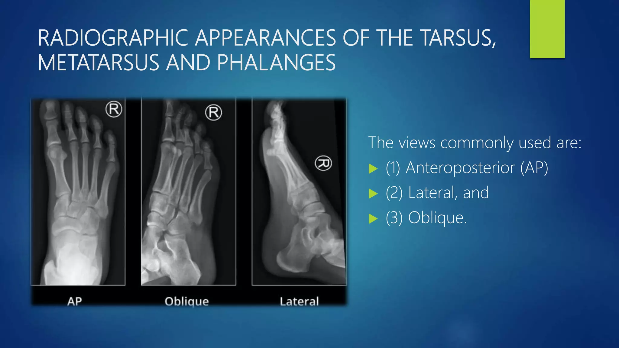 Radiology of the lower extremity dr asif ali khan | PPTX