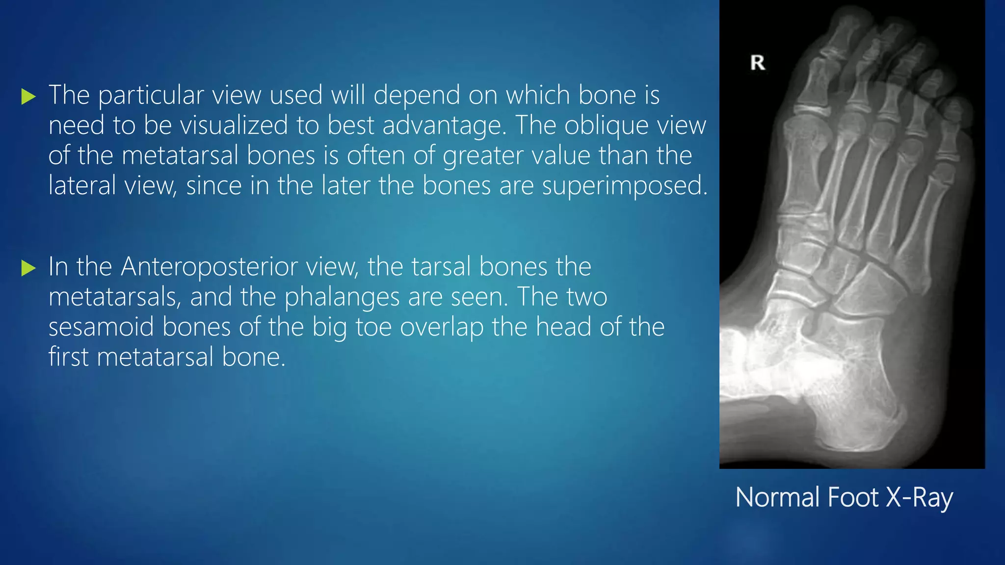 Radiology of the lower extremity dr asif ali khan | PPTX