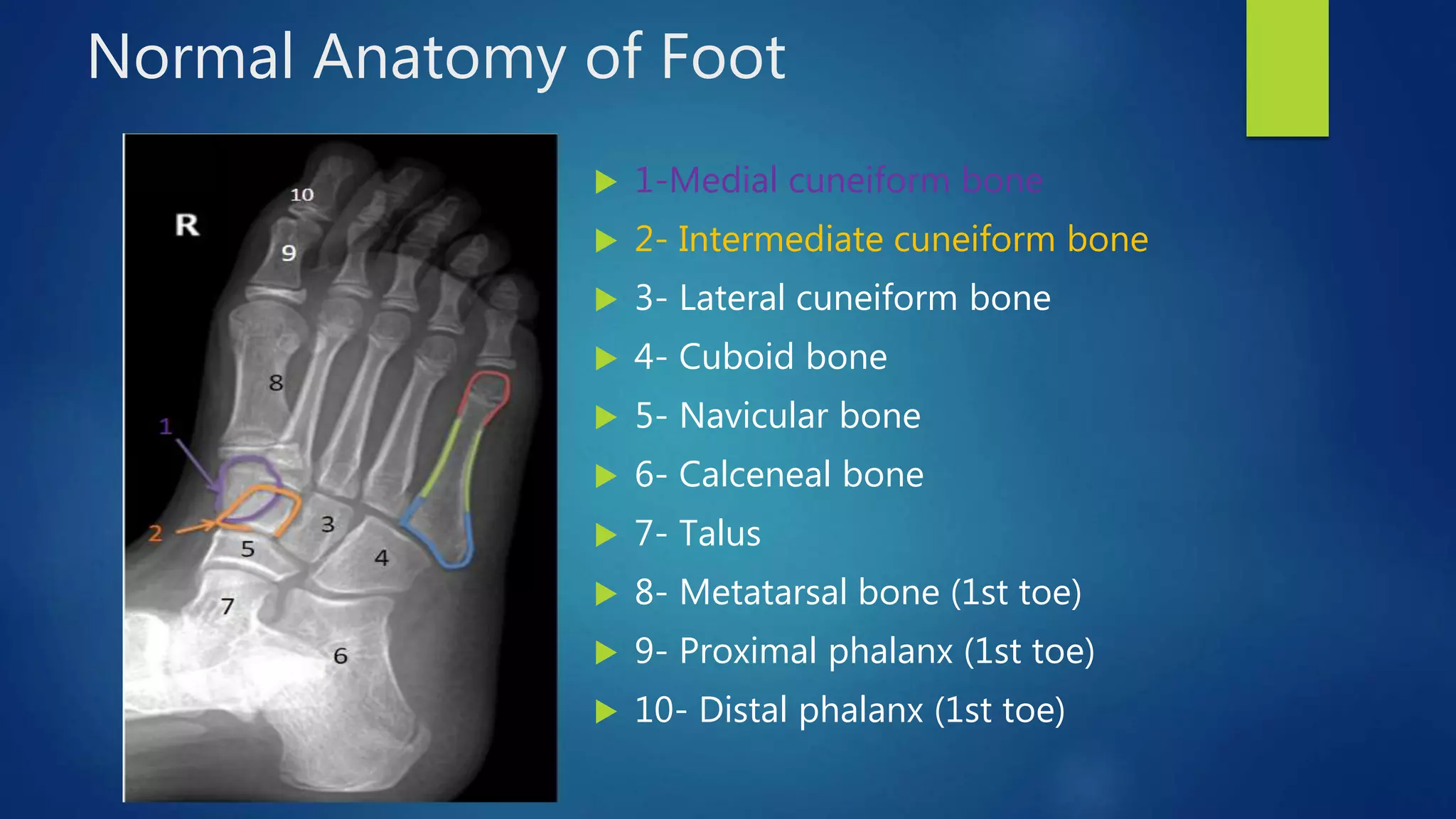 Radiology of the lower extremity dr asif ali khan | PPTX