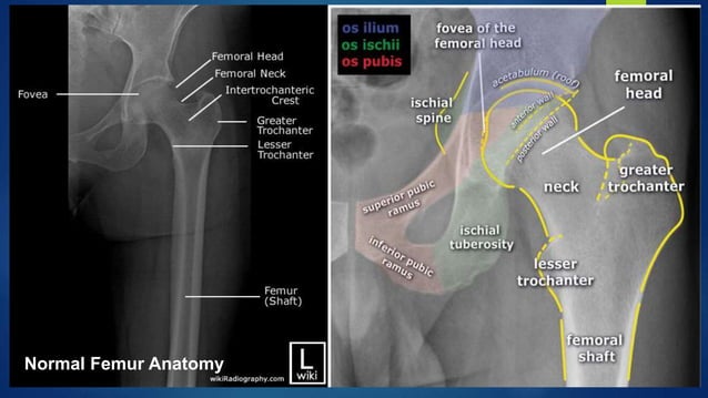 Radiology of the lower extremity dr asif ali khan | PPTX | Death ...