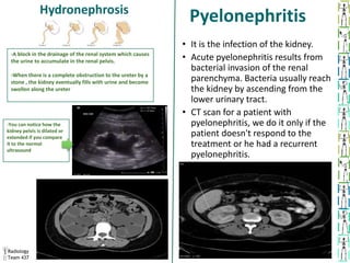 Radiology of the renal system.pptx