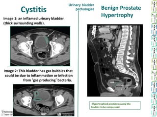 Radiology of the renal system.pptx