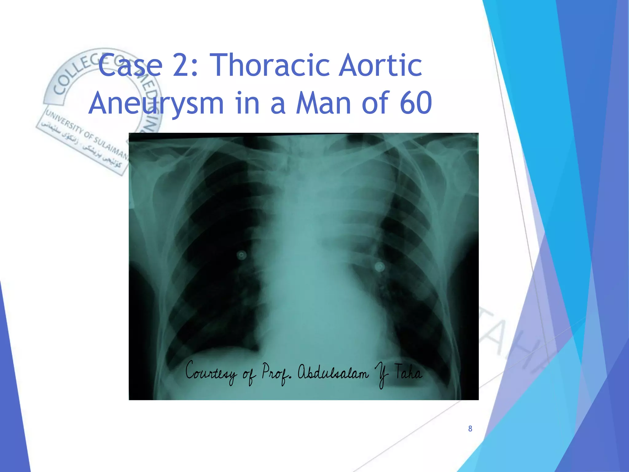 Radiology of Thoracic Aortic Aneurysms.pdf