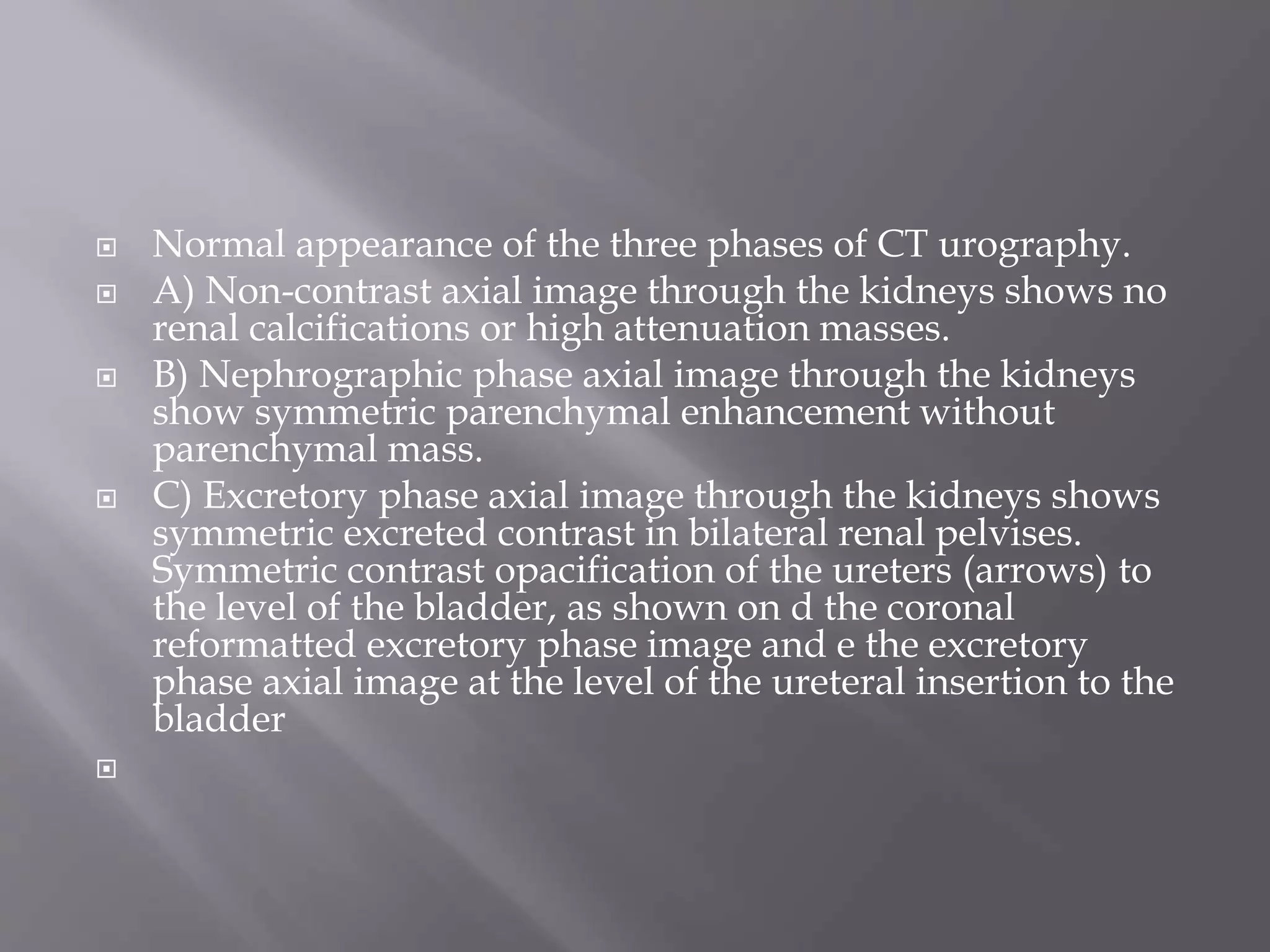 Radiology of urology | PPTX