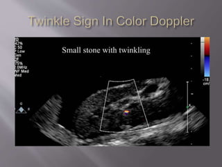 Radiology of urology | PPTX