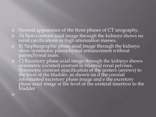 Radiology of urology | PPTX