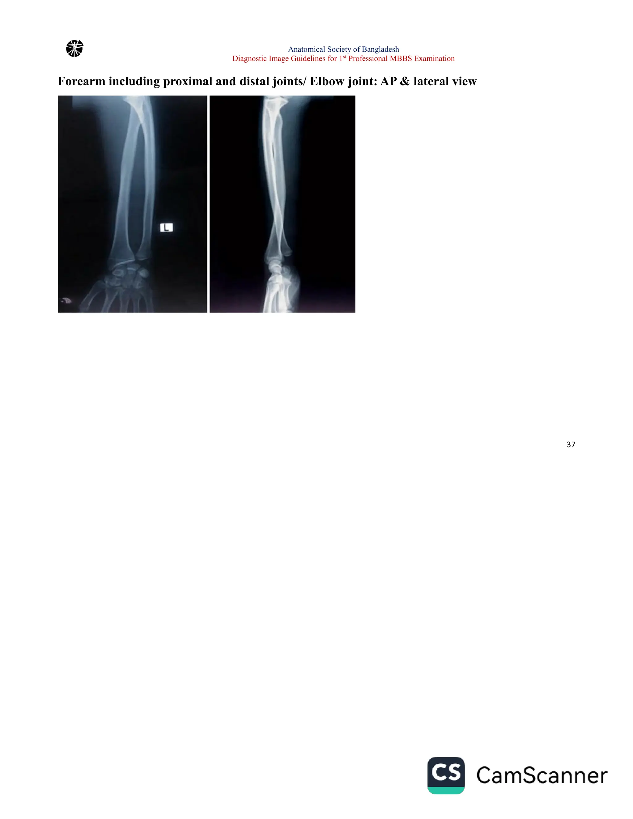 #CT Scan with horror FL callChecklist.pdf