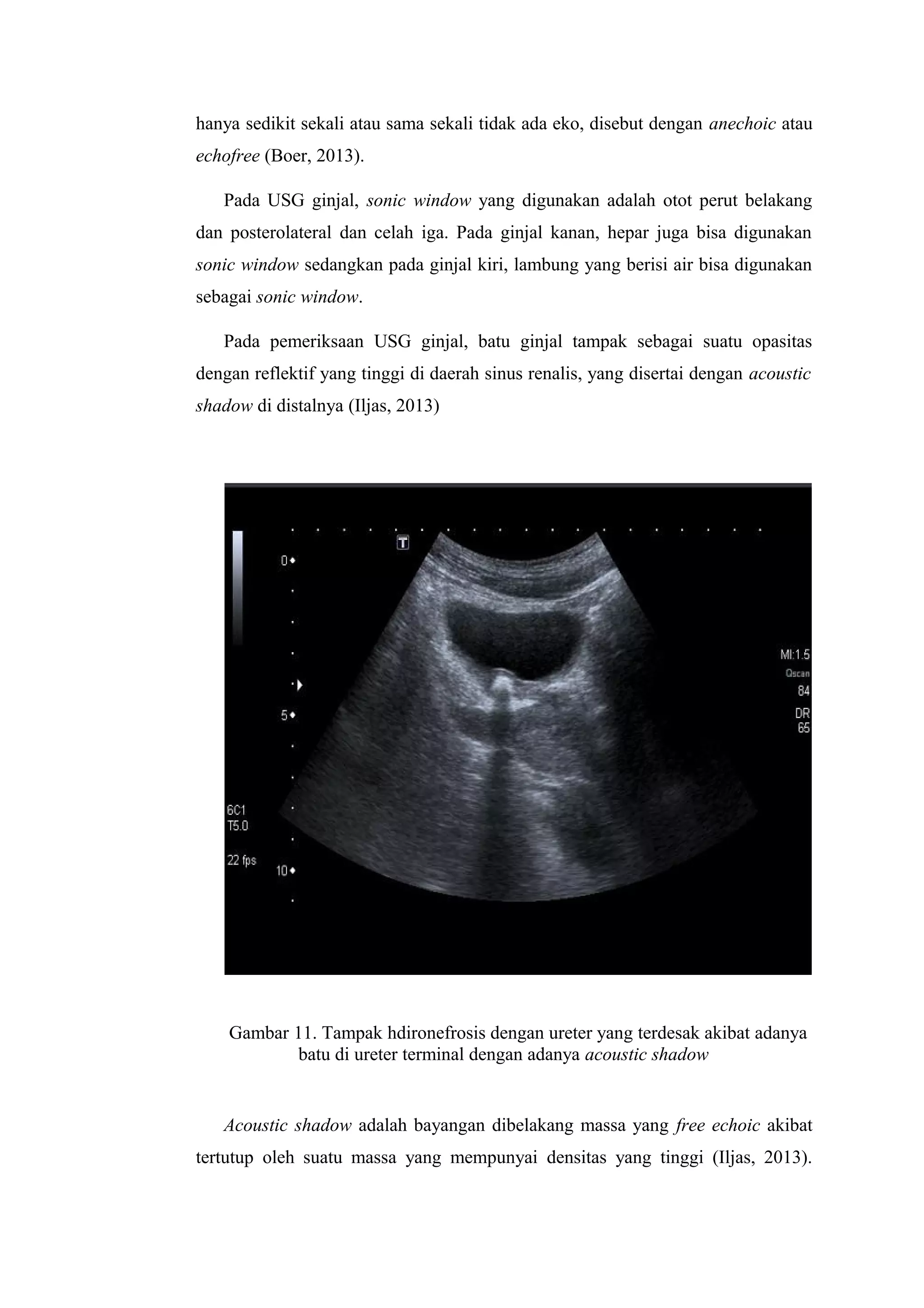 Radiology pada urolithiasis | DOC