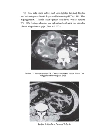 Radiology pada urolithiasis | DOC