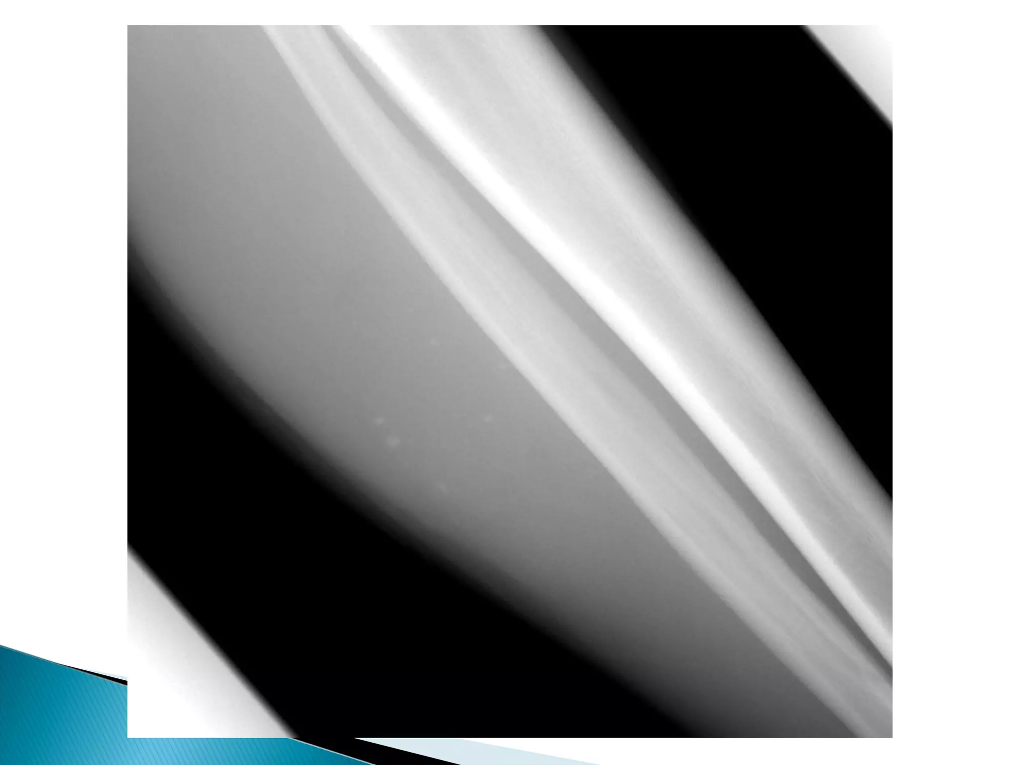 Radiology pediatric bone tumors | PPT