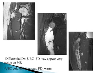 Radiology pediatric bone tumors | PPT