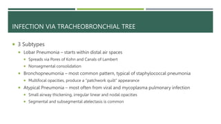 Radiology Pulmonary Infections_Two.pptx | Lung and Respiratory Health ...