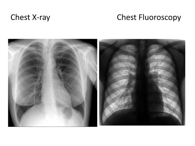 Radiology respiratory new.ppt | Lung and Respiratory Health | Diseases ...
