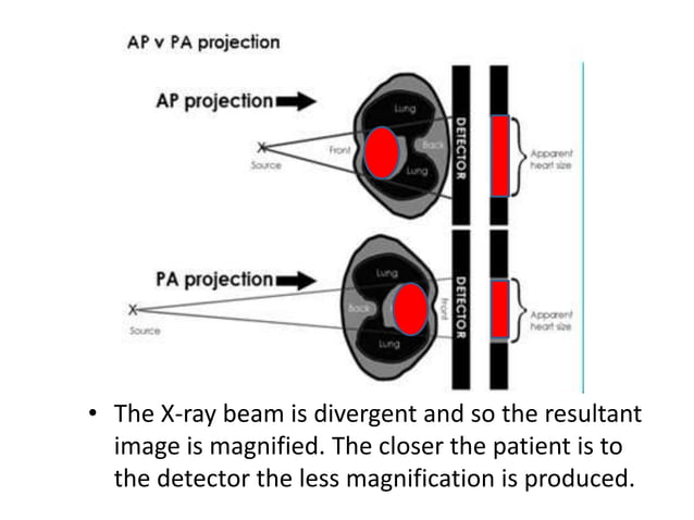 Radiology respiratory new.ppt | Lung and Respiratory Health | Diseases and Conditions