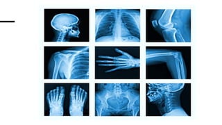 RADIOLOGY_SATHI BARMAN_Sujoy Tontubay.pptx