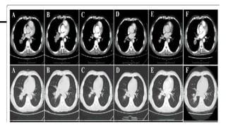 RADIOLOGY_SATHI BARMAN_Sujoy Tontubay.pptx