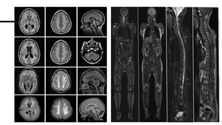 RADIOLOGY_SATHI BARMAN_Sujoy Tontubay.pptx