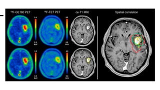 RADIOLOGY_SATHI BARMAN_Sujoy Tontubay.pptx