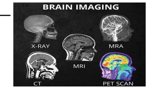 RADIOLOGY_SATHI BARMAN_Sujoy Tontubay.pptx