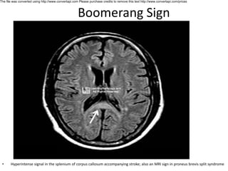 Classical radiology signs by shah zeb.pdf