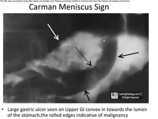 Classical radiology signs by shah zeb.pdf
