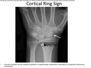 Classical radiology signs by shah zeb.pdf