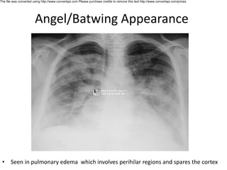 Classical radiology signs by shah zeb.pdf