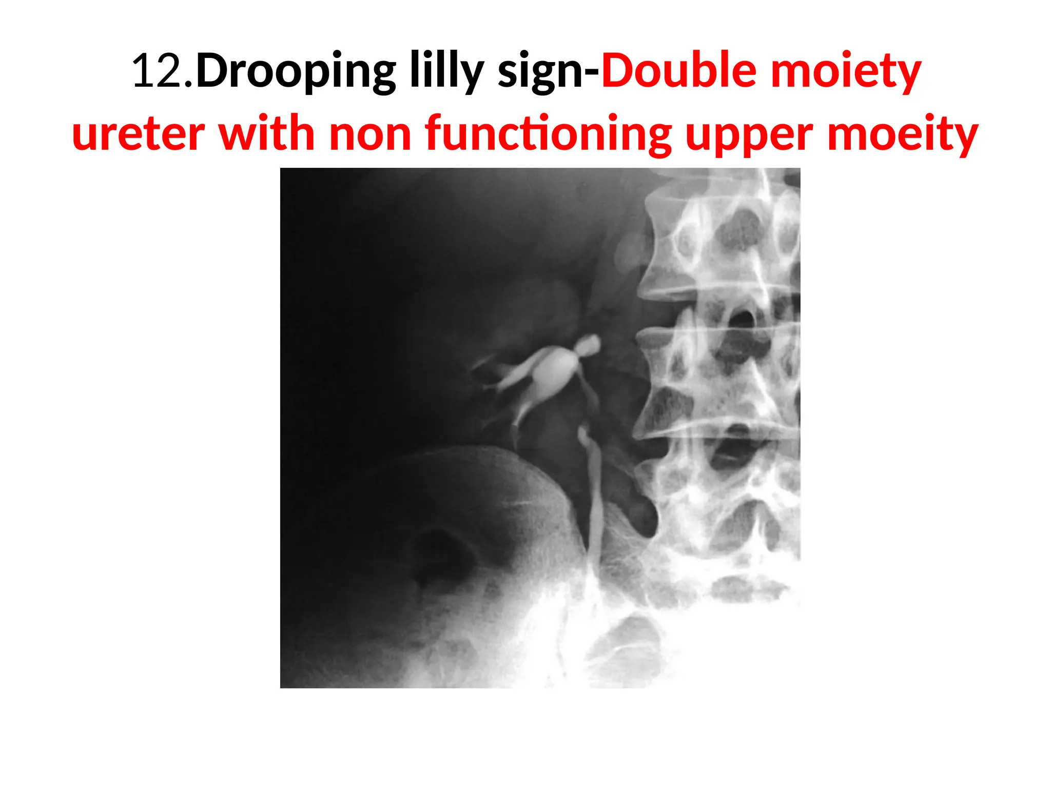 RADIOLOGY SIGNS JULY24 signs signs signed.pptx