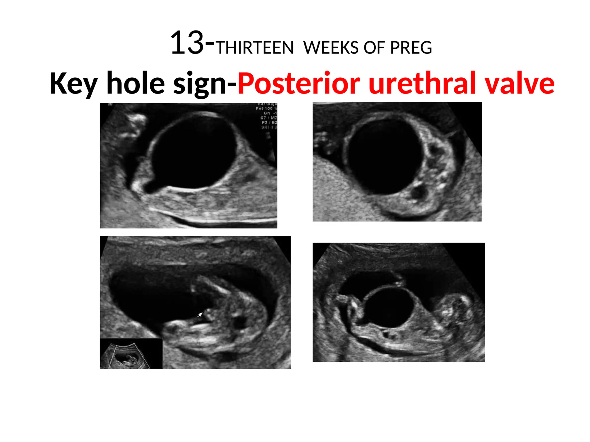 RADIOLOGY SIGNS JULY24 signs signs signed.pptx