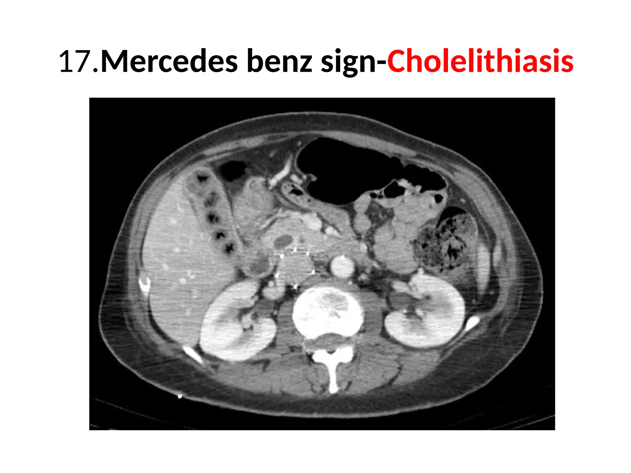 RADIOLOGY SIGNS JULY24 signs signs signed.pptx