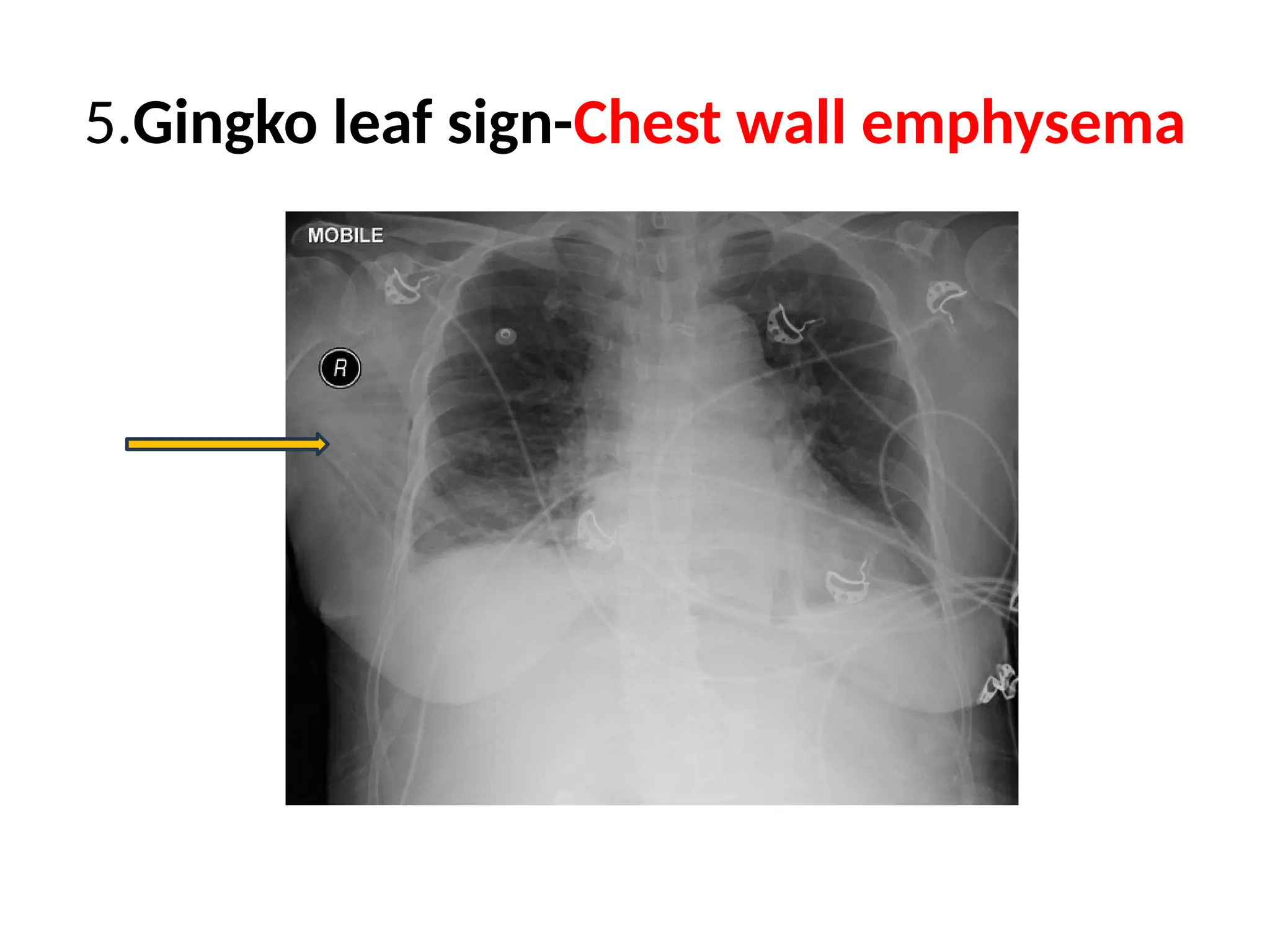 RADIOLOGY SIGNS JULY24 signs signs signed.pptx