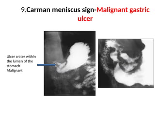 RADIOLOGY SIGNS JULY24 signs signs signed.pptx