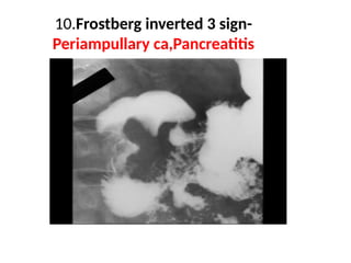 RADIOLOGY SIGNS JULY24 signs signs signed.pptx