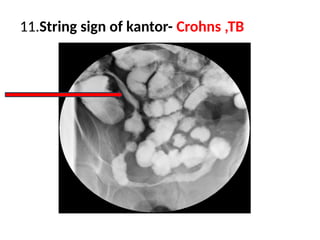 RADIOLOGY SIGNS JULY24 signs signs signed.pptx
