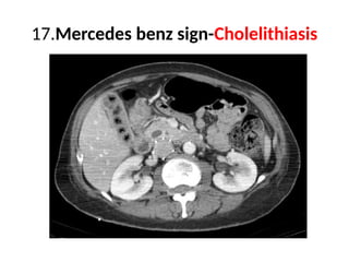 RADIOLOGY SIGNS JULY24 signs signs signed.pptx