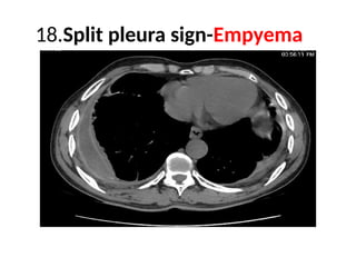 RADIOLOGY SIGNS JULY24 signs signs signed.pptx